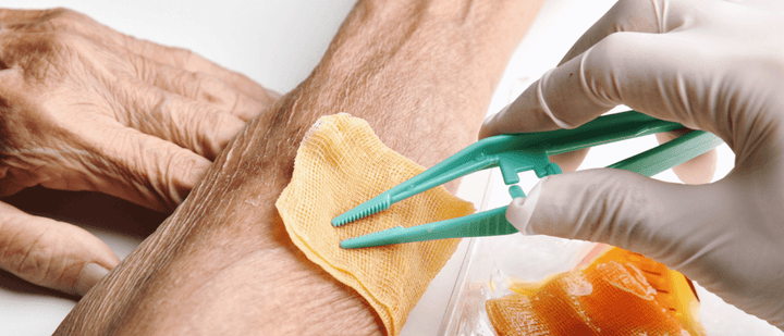 Wound Care Supplies | Sterile Dressings & Irrigation – Consumer's ...
